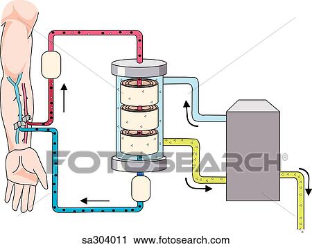 Schematic dialysis demonstrating the principles of dialysis. Clip Art ...