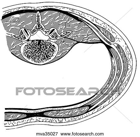 Rectus sheath, canine Stock Illustration | mva35027 | Fotosearch