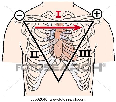 Einthoven triangle, 2 Clipart | ccp02040 | Fotosearch