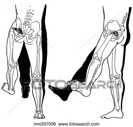 Piriformis, shortened Stock Illustration | mm207006 | Fotosearch